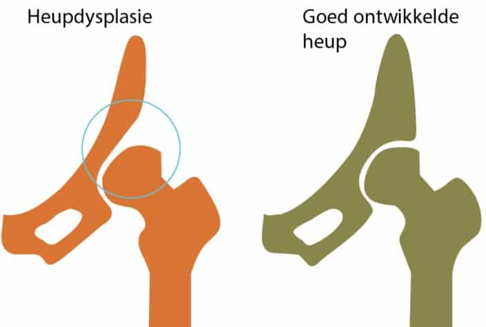 Heupafwijking (heupdysplasie) bij je baby? Fysiopark helpt!