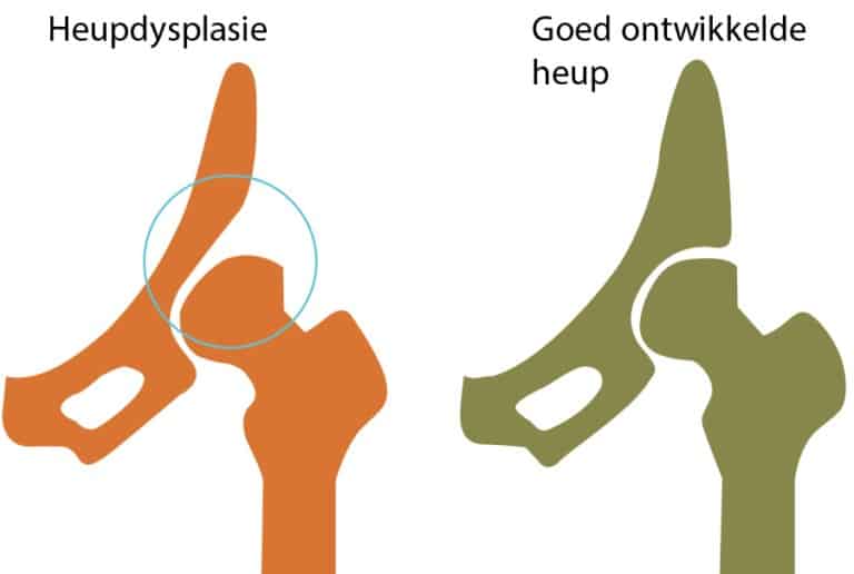 Heupafwijking (heupdysplasie) bij je baby? Fysiopark helpt!